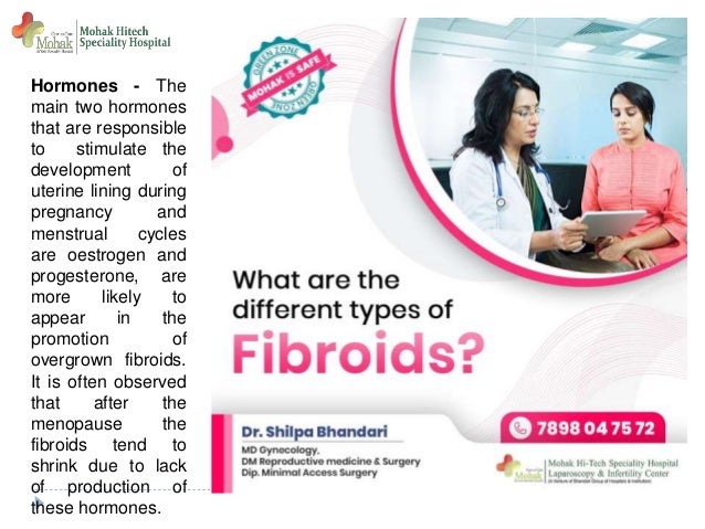Fibroids: Types, Causes, and treatment