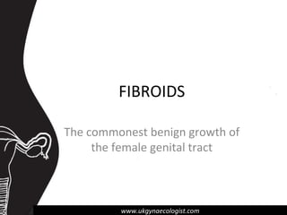 management of uterine fibroids | PPT