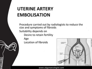 management of uterine fibroids | PPT