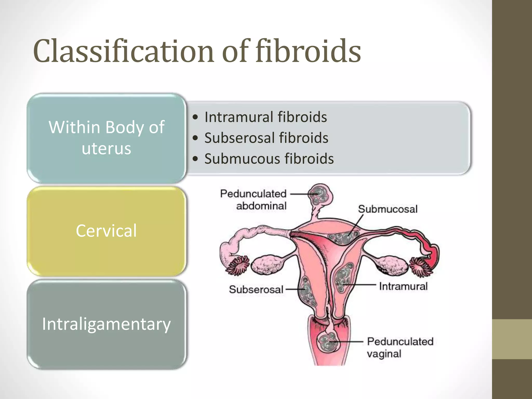 Fibroid uterus by Dr waseem sajjad | PPTX
