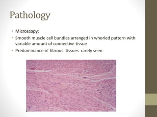 Fibroid uterus by Dr waseem sajjad | PPTX
