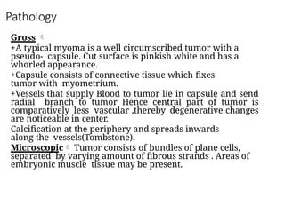 Fibroid Uterus - etiology, diagnosis and management | PPTX
