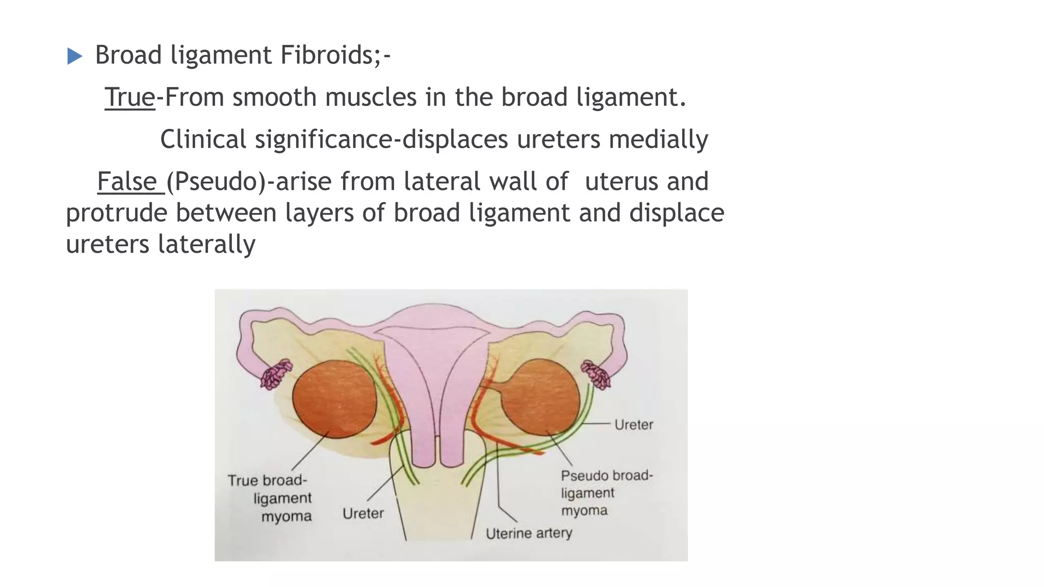 fibroid uterus Dr Sumangali.pptx