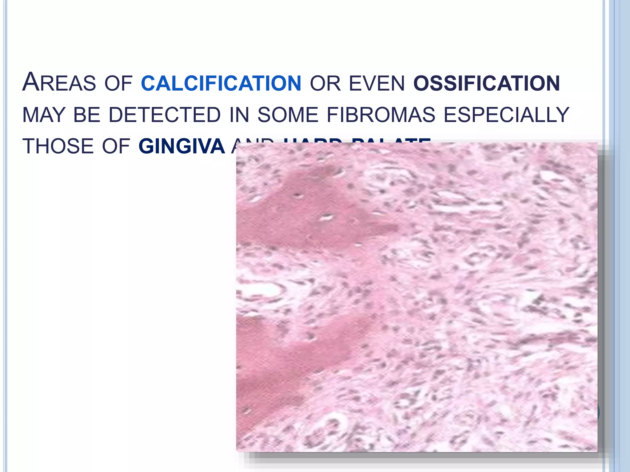 Fibroma- benign tumors | PPTX