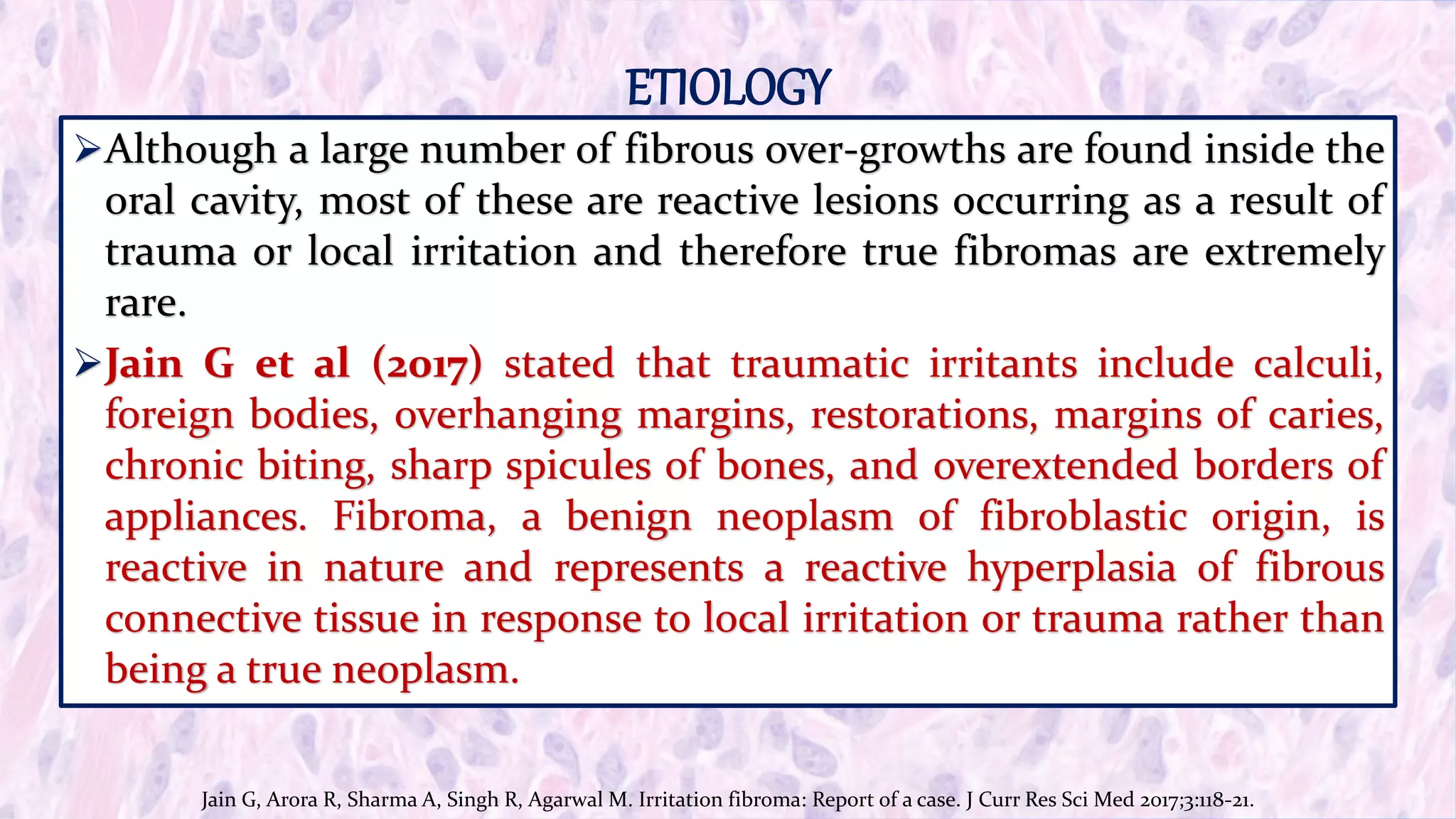 Fibroma | PPTX