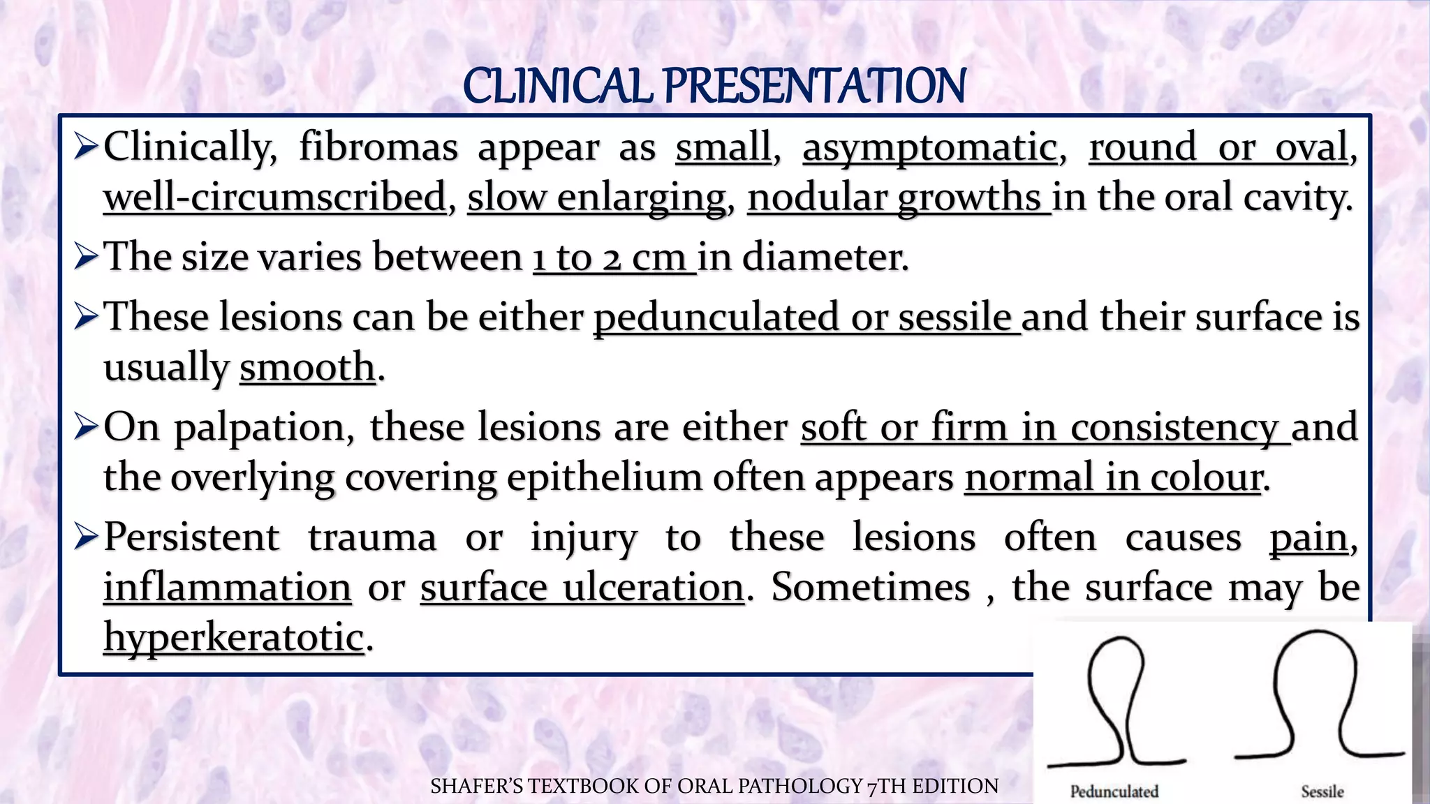 Fibroma | PPTX