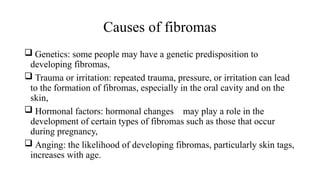 FIBROMAS clinical presentation and management | PPTX