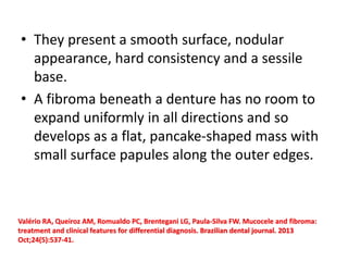 Fibroma case presentation | PPTX