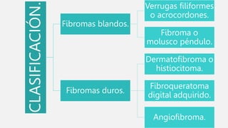 FIBROMAS.pptx
