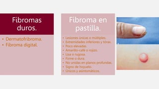FIBROMAS.pptx