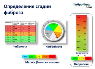 ФиброМетр | PPT