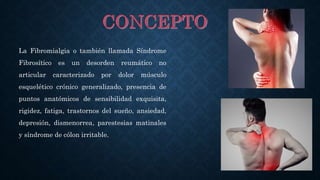 FIBROMIALGIA | PPTX