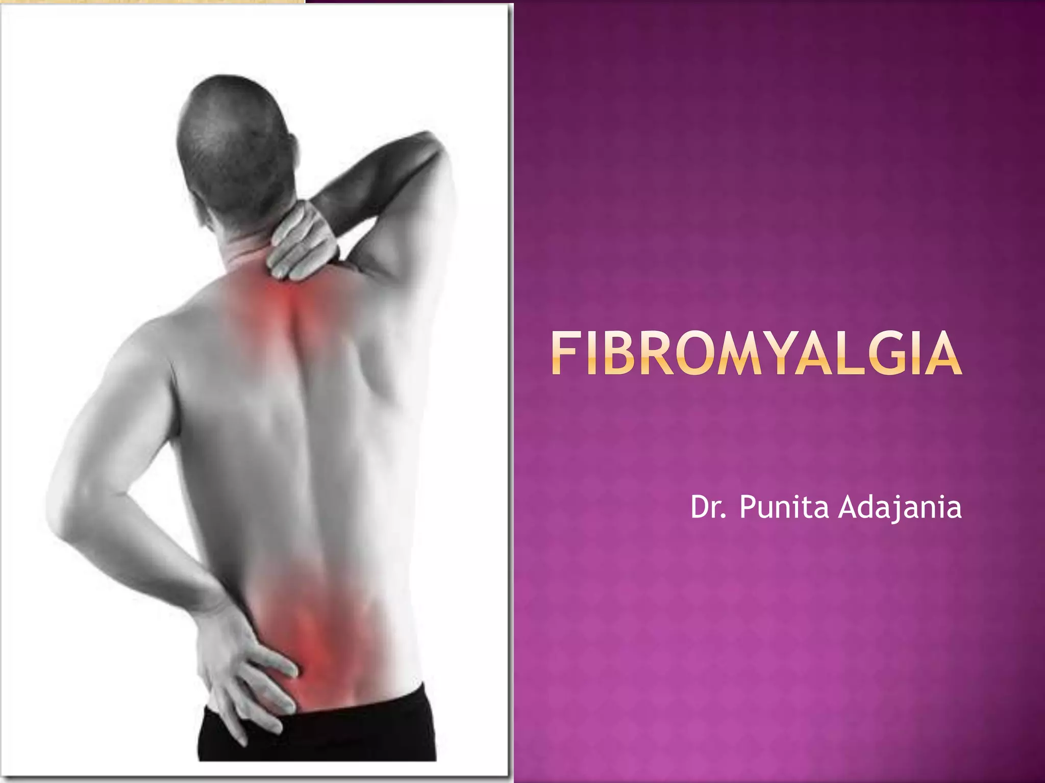 Fibromyalgia | PPTX