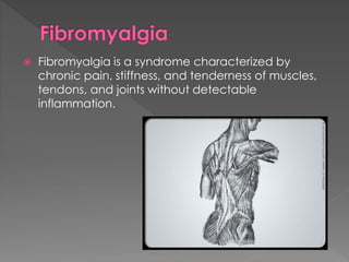Fibromyalgia | PPTX