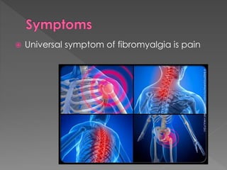 Fibromyalgia | PPTX
