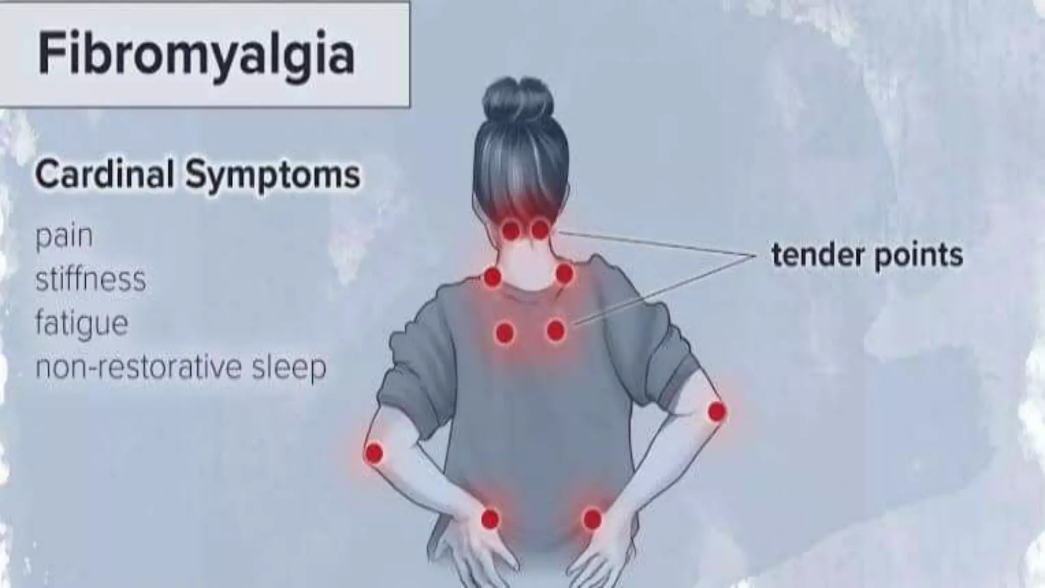 Fibromyalgia - medical information | PPT