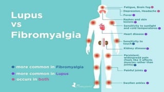 Fibromyalgia - medical information | PPTX