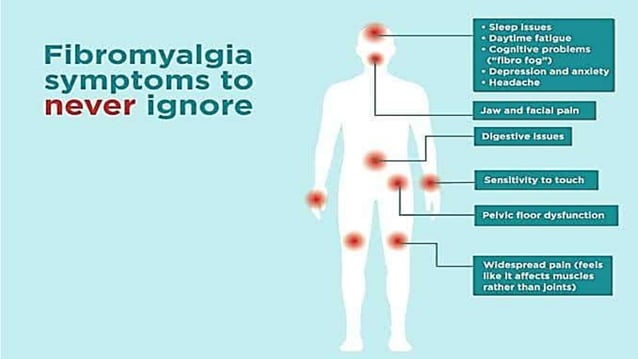 Fibromyalgia - medical information | PPT