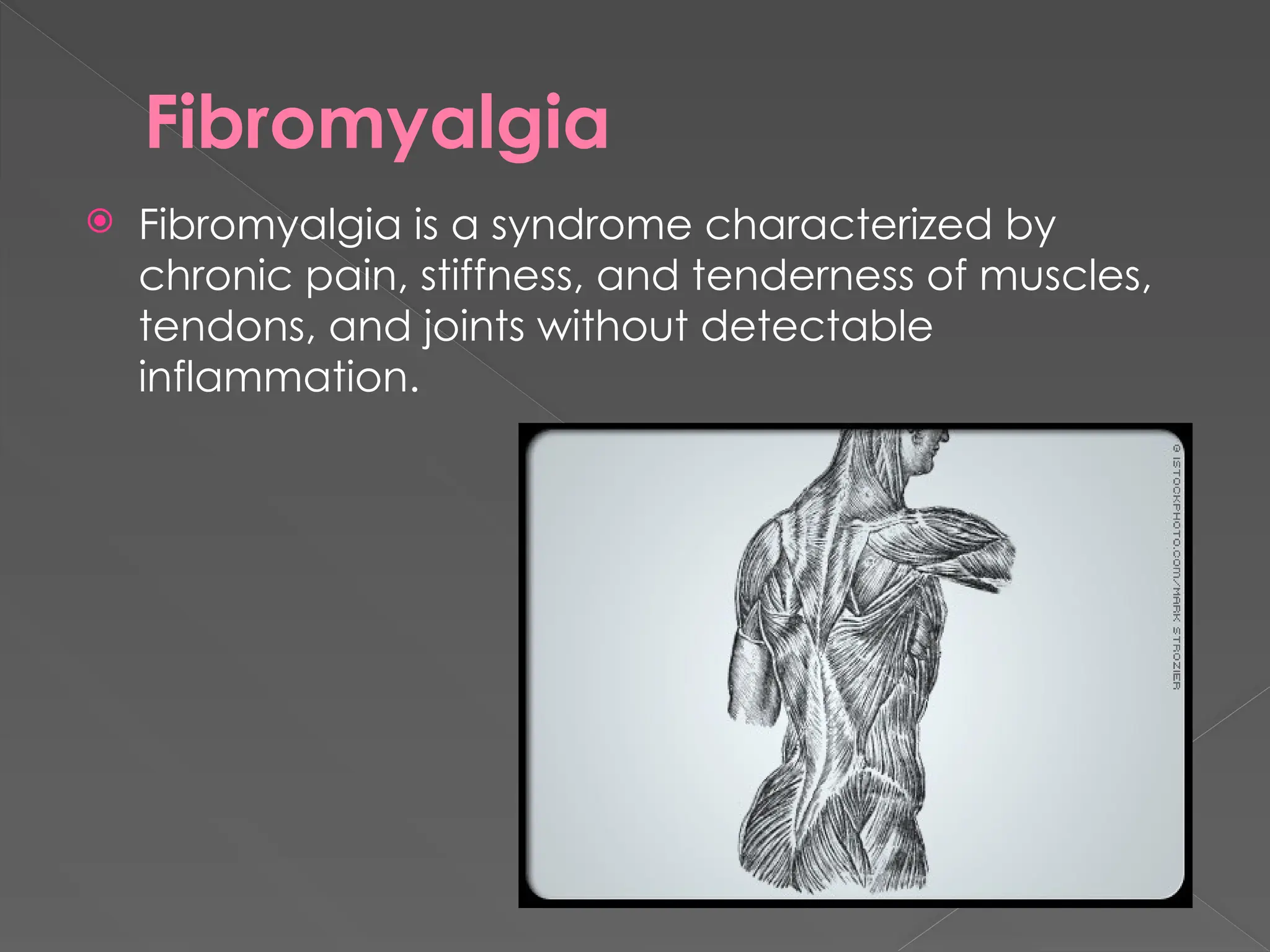 FIBROMYALGIA- Introduction, definition, causes, sign and symptoms ...