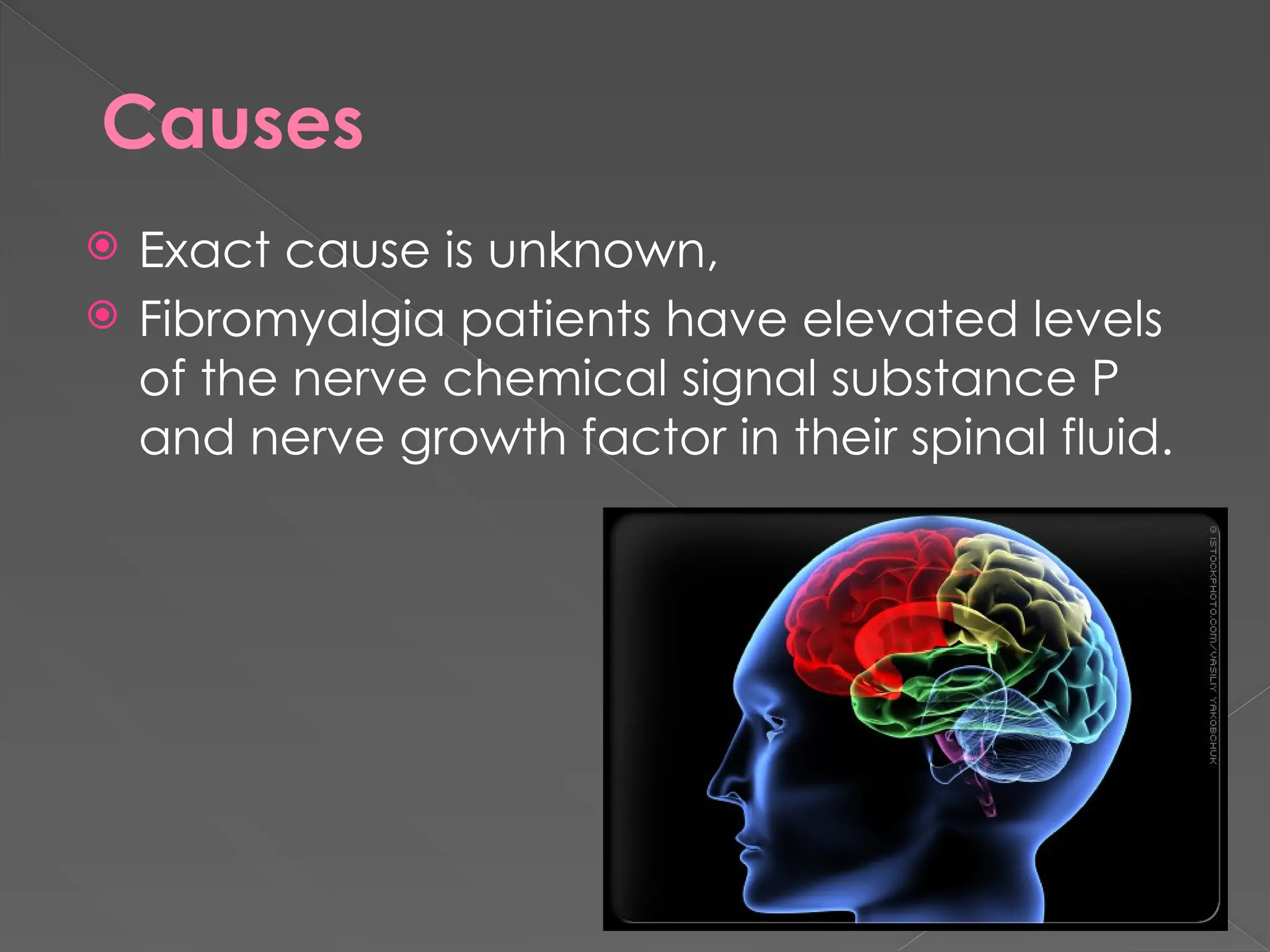 FIBROMYALGIA- Introduction, definition, causes, sign and symptoms ...