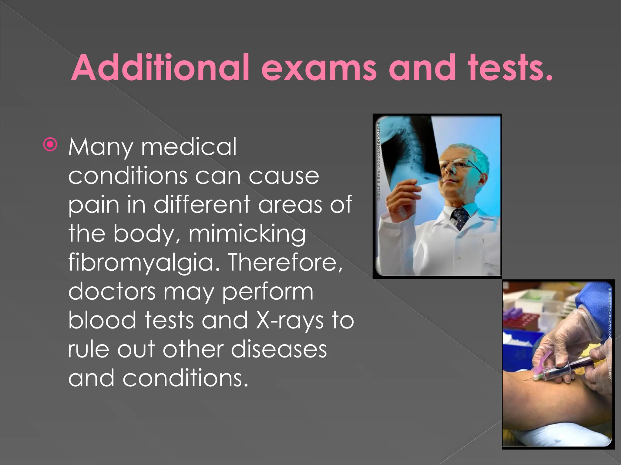 FIBROMYALGIA- Introduction, definition, causes, sign and symptoms ...