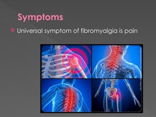 FIBROMYALGIA- Introduction, definition, causes, sign and symptoms ...