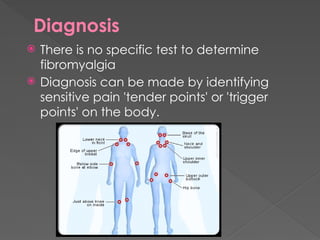 FIBROMYALGIA- Introduction, definition, causes, sign and symptoms ...