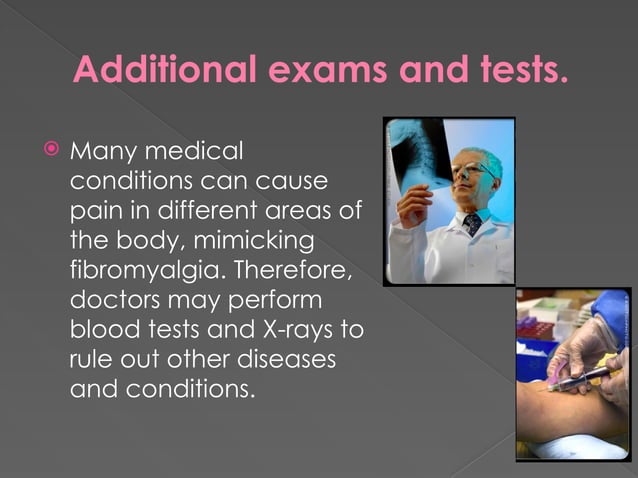 FIBROMYALGIA- Introduction, definition, causes, sign and symptoms ...