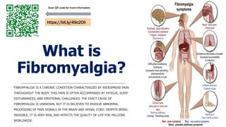 Understanding Fibromyalgia: Symptoms, Causes, and Treatment Options | PPT
