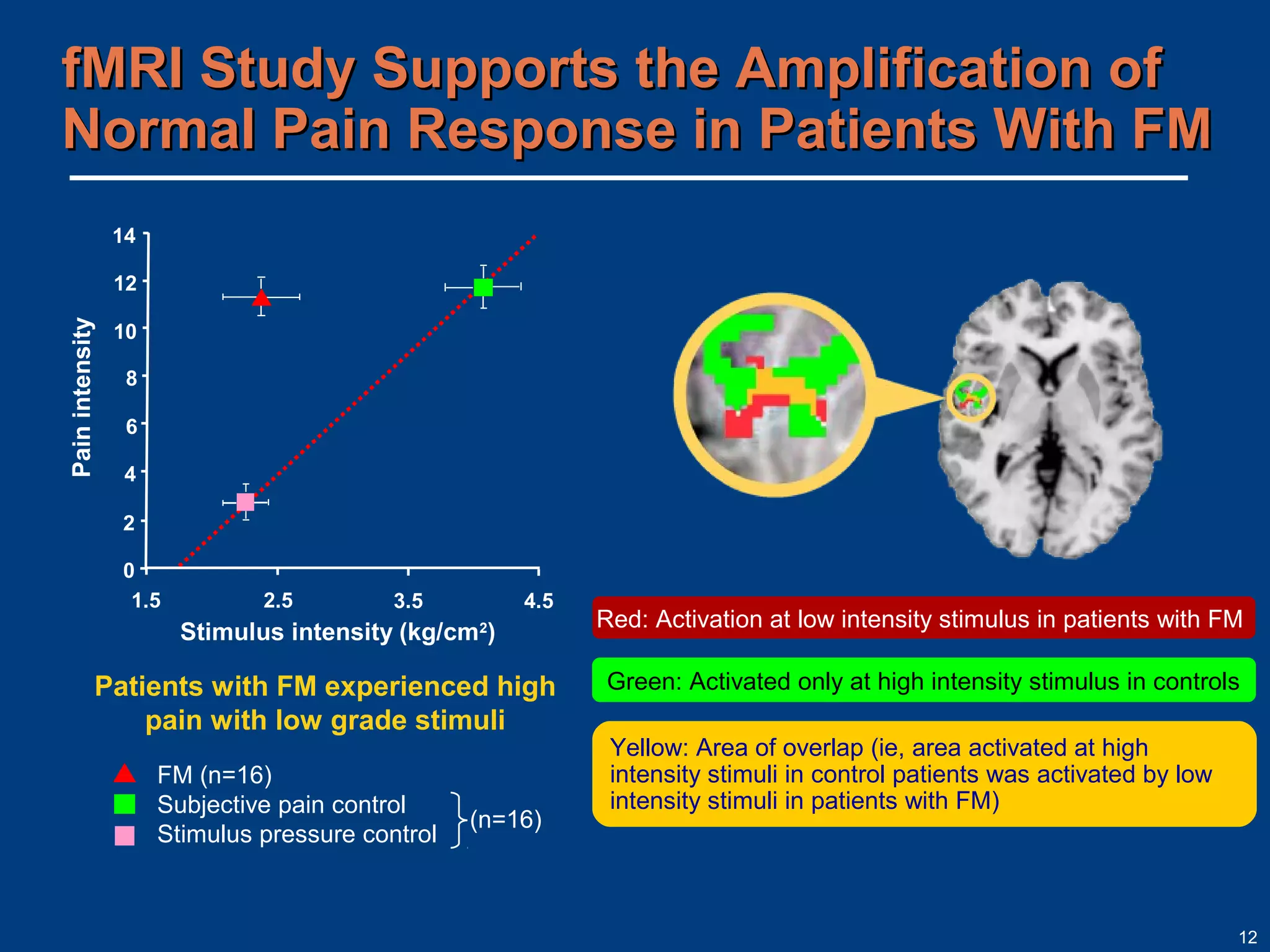 Fibromyalgia disease overview | PPT