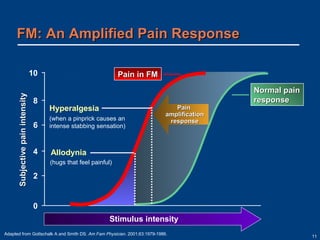 Fibromyalgia disease overview | PPT