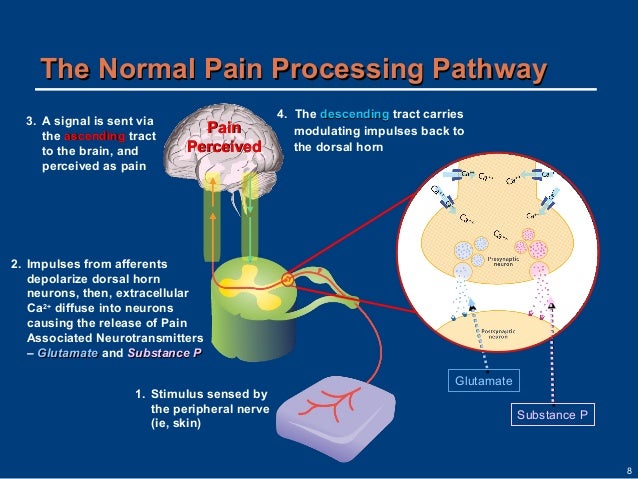 Types Of Flowchart Overview Fibromyalgia Disease Overview