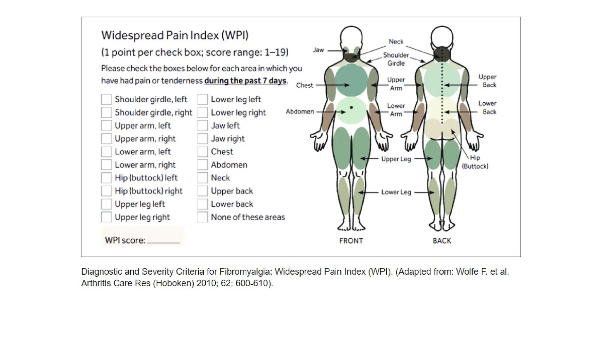 fibromyalgia versus myofascial pain syndrome mps trigger points .pptx