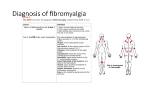 fibromyalgia versus myofascial pain syndrome mps trigger points .pptx
