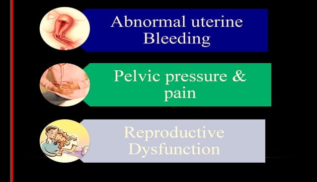 Fibromyoma uterus by Dr. H.K Cheema | PDF | Pregnancy | Reproductive Health