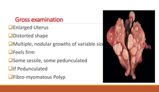 Fibromyoma uterus by Dr H.K.Cheema | PDF
