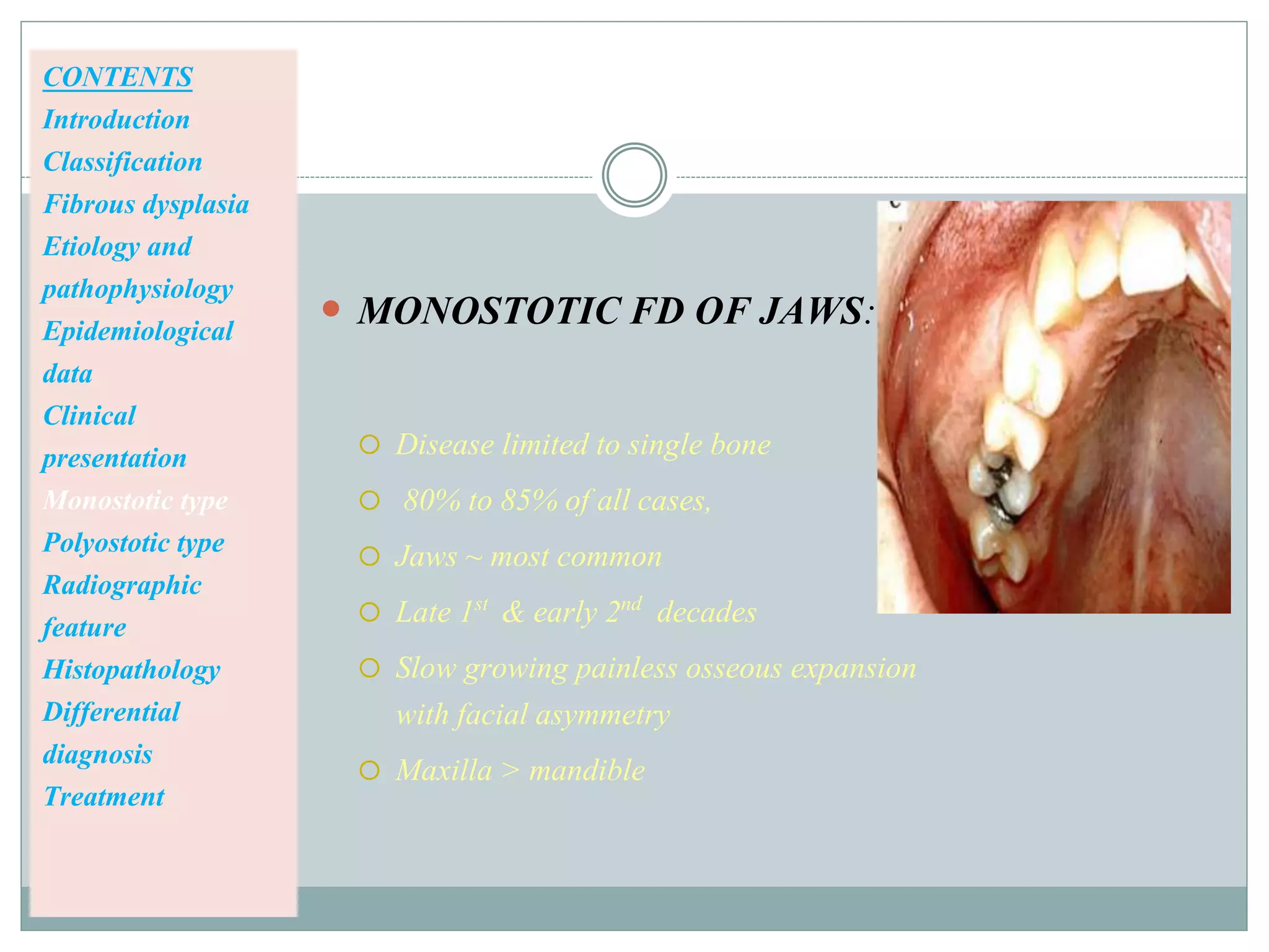 Diseases Of Bone Manifested in Jaw | PPTX