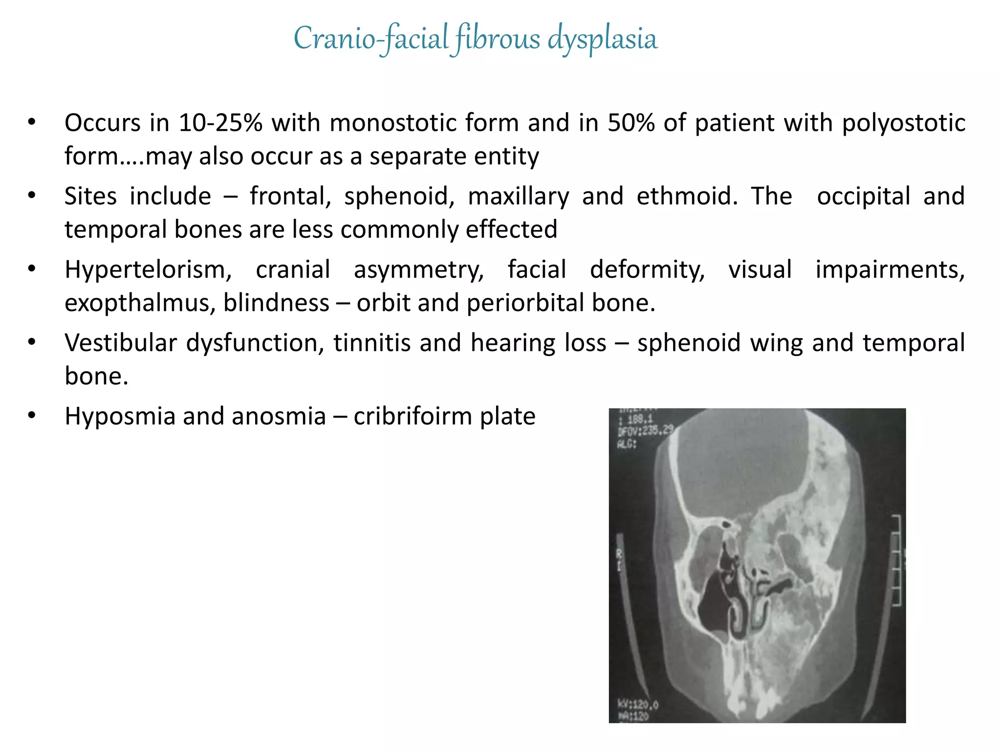 Fibroosseous lesions | PPTX