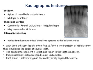 Fibroosseous lesions | PPTX