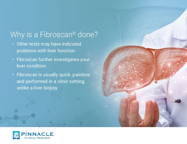 What is Fibroscan?
