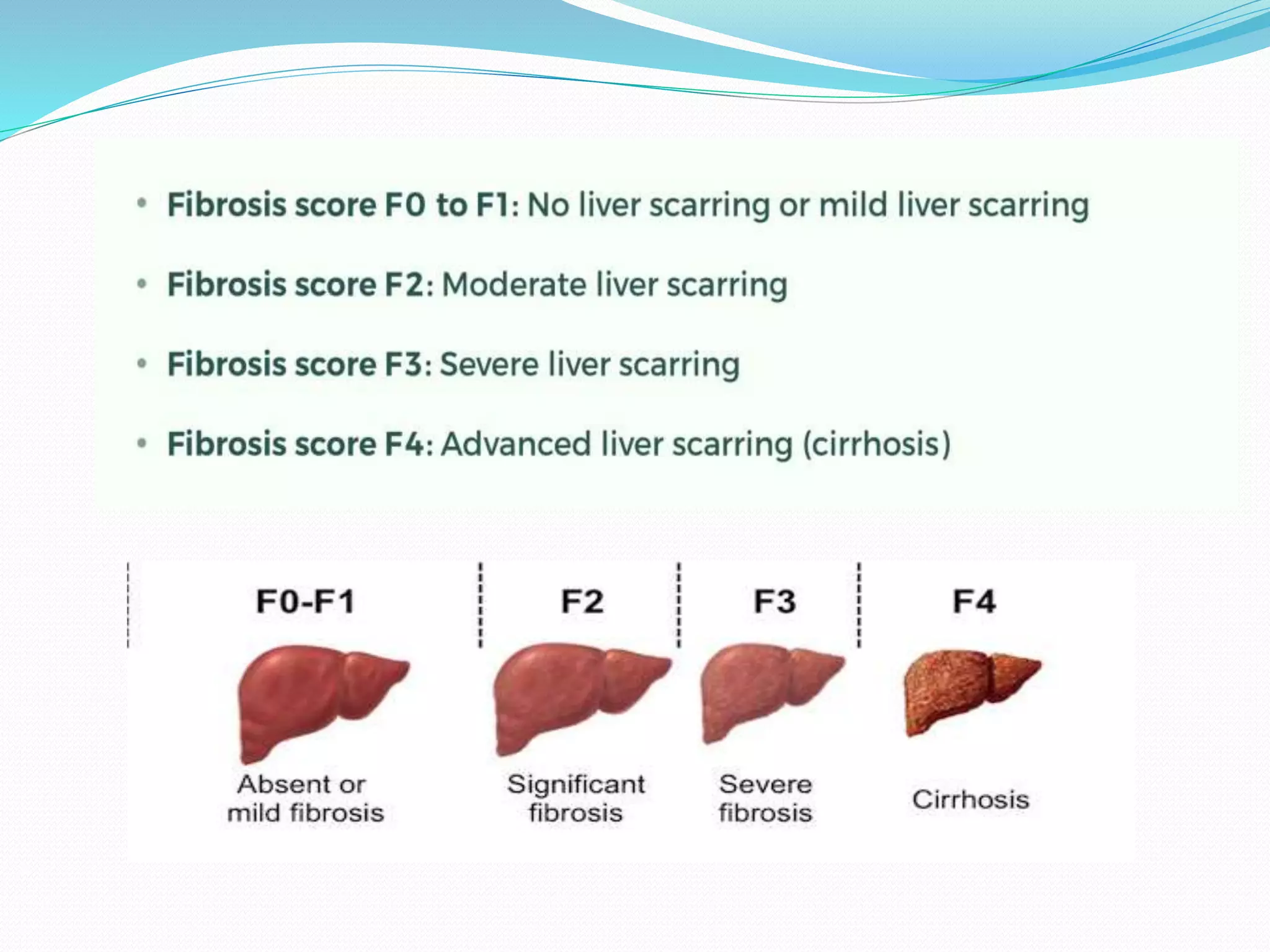 Fibroscan.dr quiyum | PPTX