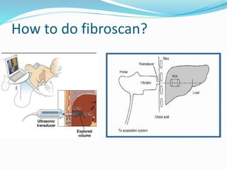 How To Perform A Fibroscan : FibroScan® Operator Training – WOLMDE