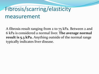Fibroscan.dr quiyum | PPTX