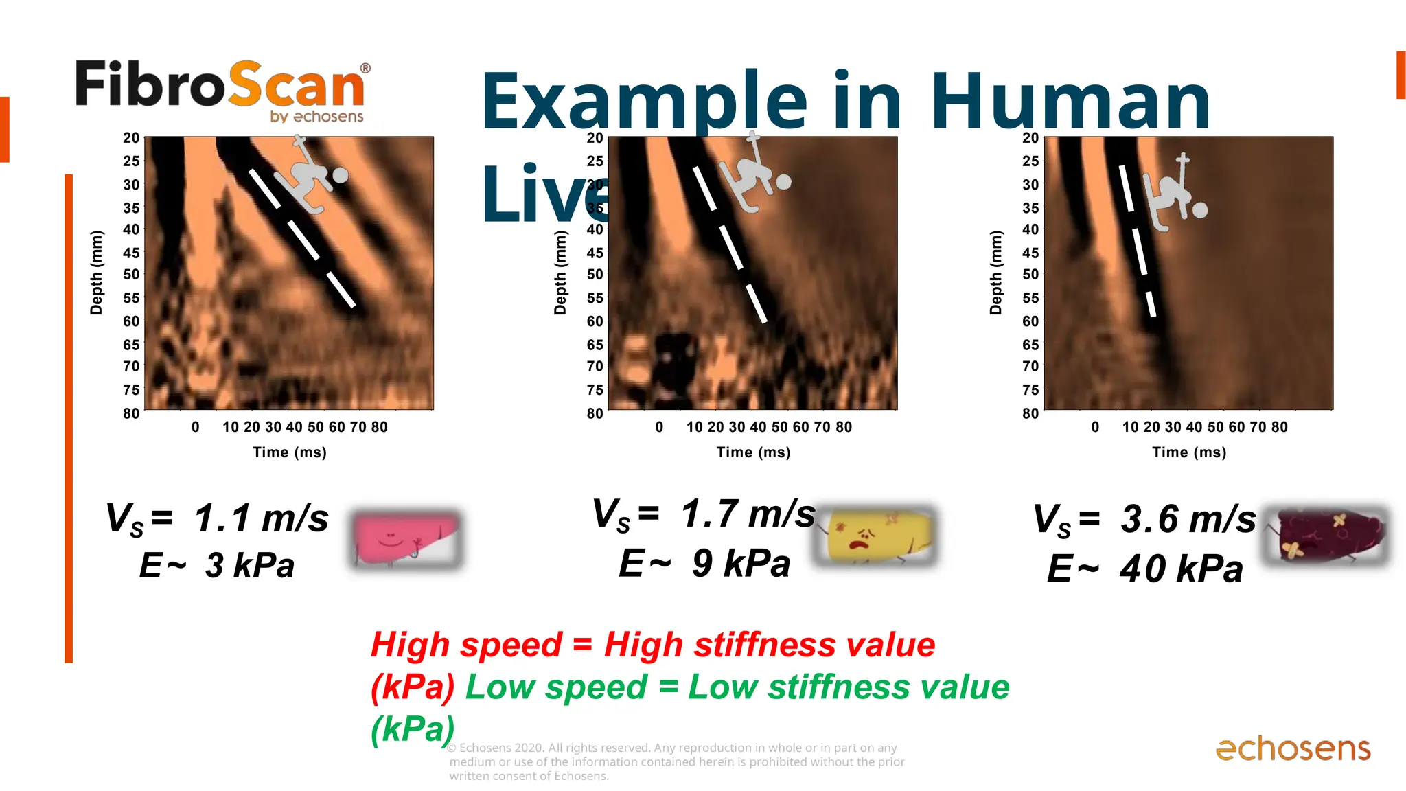 Fibroscan PPT_Jul 2bbdjduhgvvdjnshnwuugev024.pptx