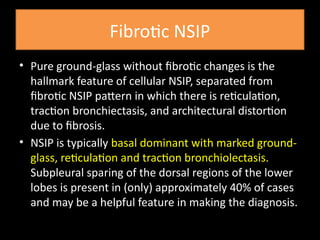 Fibrotic Hypersensitivity pneumonitis.pptx