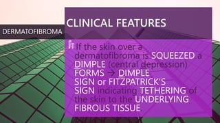 Fibrous and Fibrohistiocytic Proliferations of the Skin P.II