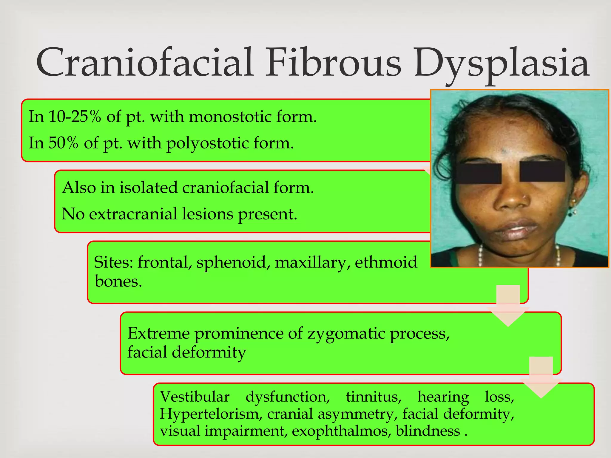 Fibrousdysplasia | PPTX