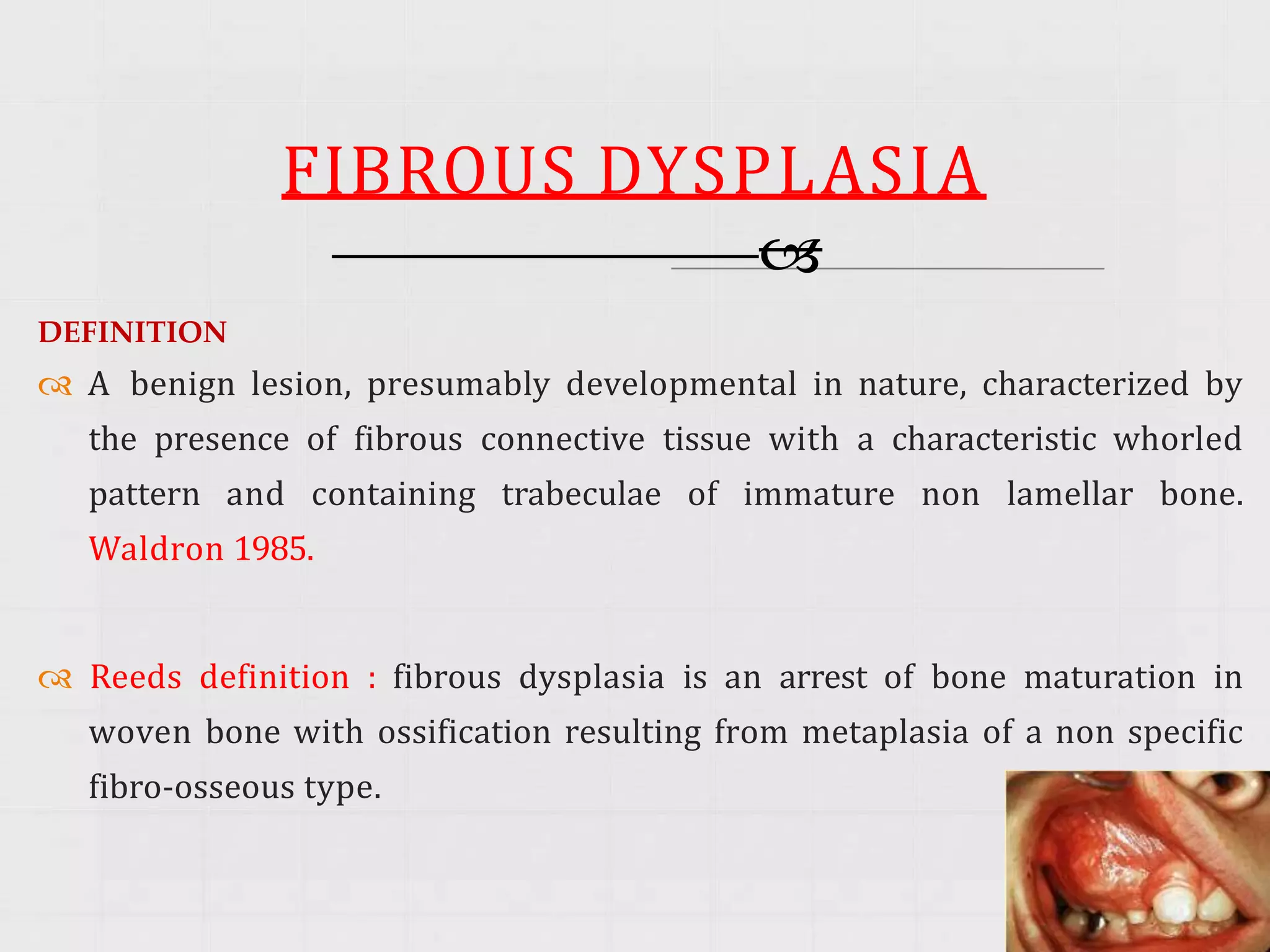 Fibrous dysplasia.pptx