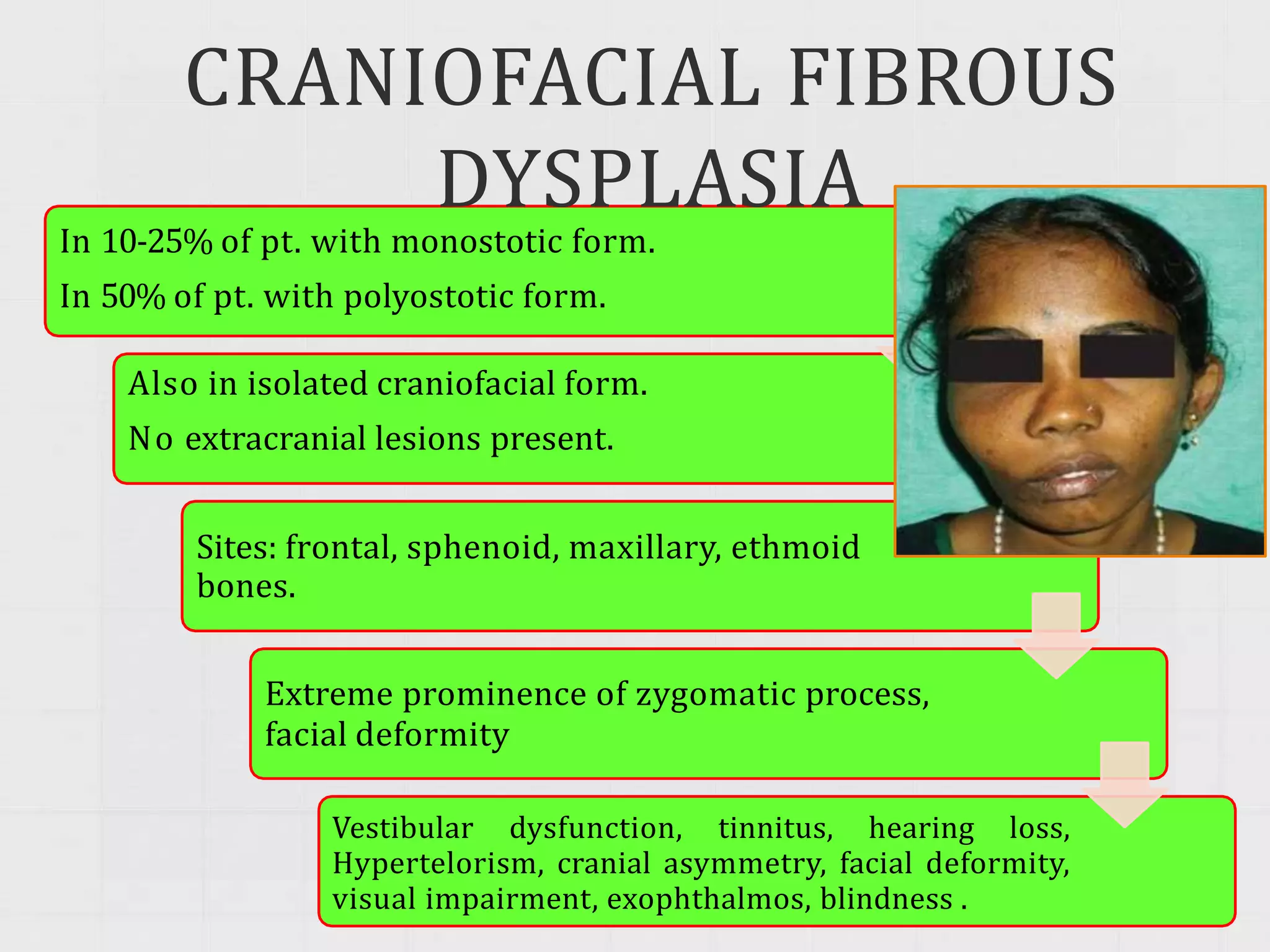 Fibrous dysplasia.pptx