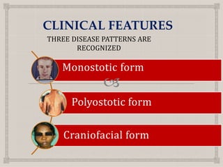 Fibrous dysplasia.pptx